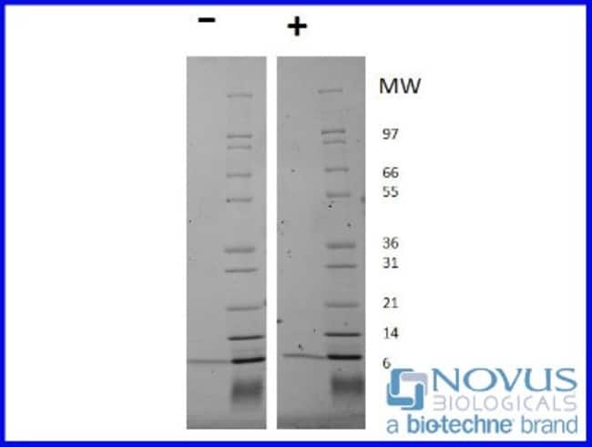 Novus Biologicals Recombinant Human Neuregulin-1 beta 1/NRG1 beta 1 ... Novus Biologicals Recombinant Human Neuregulin-1 beta 1/NRG1 beta 1 ...